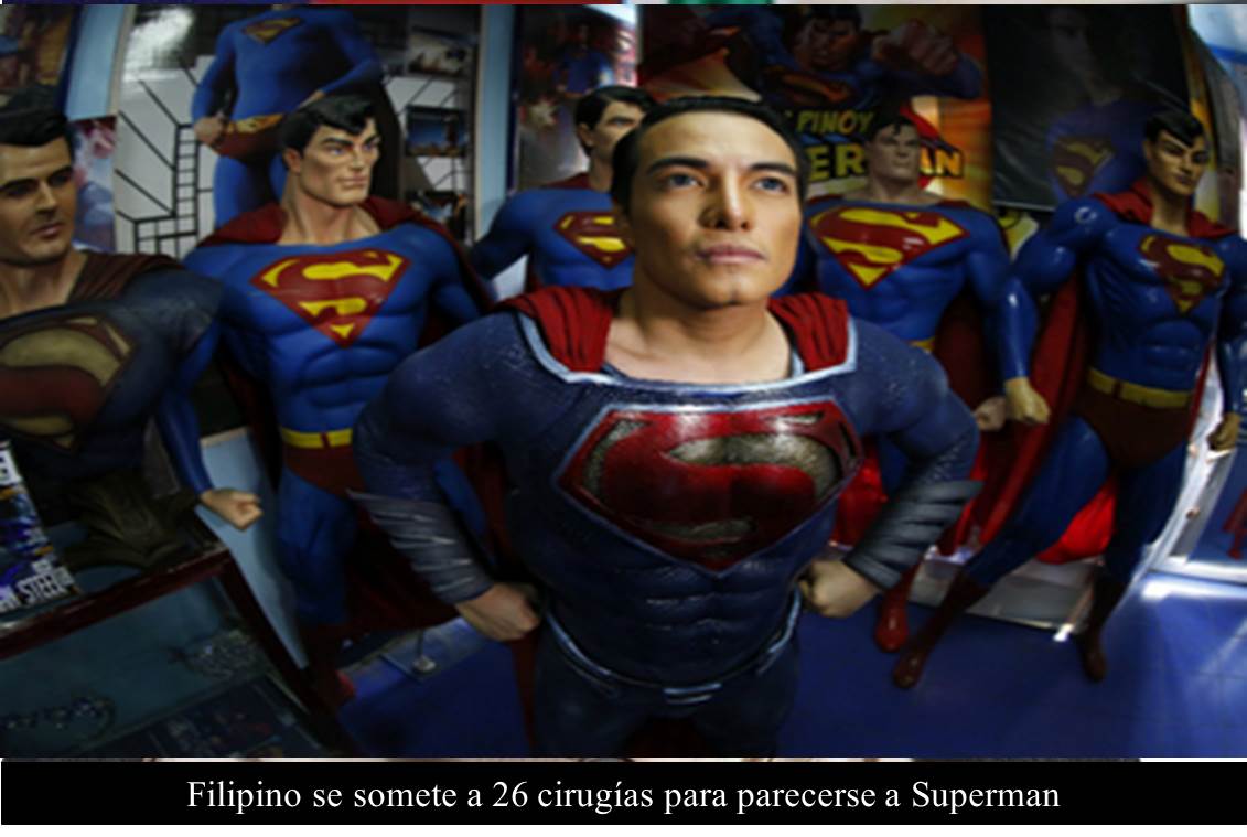 Filipino se somete a 26 cirugías para parecerse a Superman