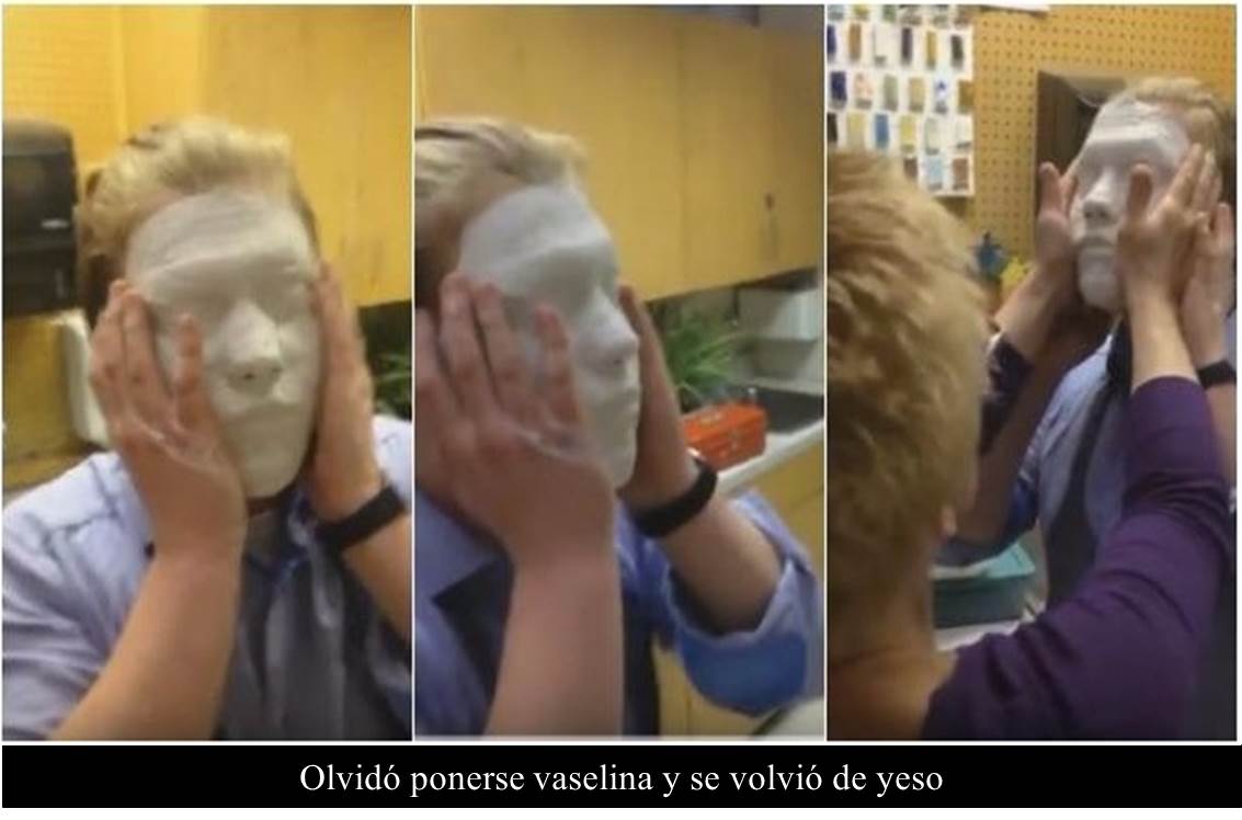 Olvidó ponerse vaselina y se volvió de yeso